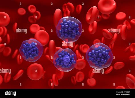 Diffuse Large B Cell Lymphoma Dlbcl Isometric View 3d Illustration