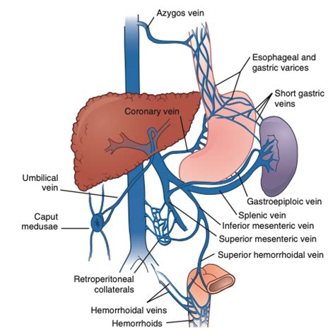 Diagram Of Portal Hypertension Quizlet