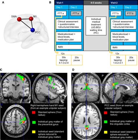 Motor Performance And Functional Connectivity Between The Posterior Cingulate Cortex And