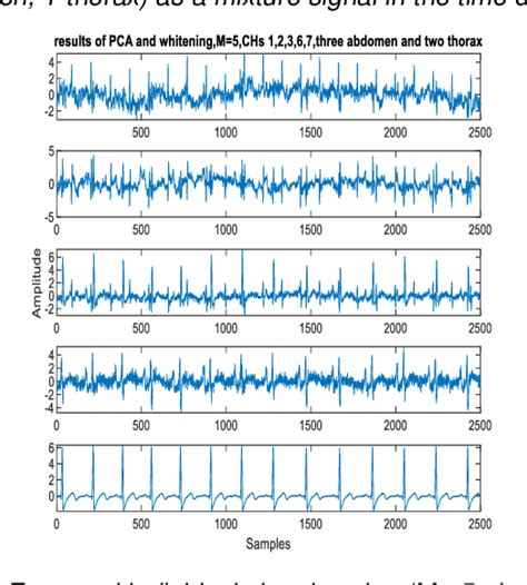 Figure 12 From Blind Source Separation Of Fetal Ecg Using Fast Independent Component Analysis