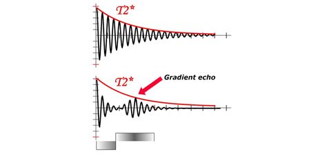 mri sequences gradient echo e mri