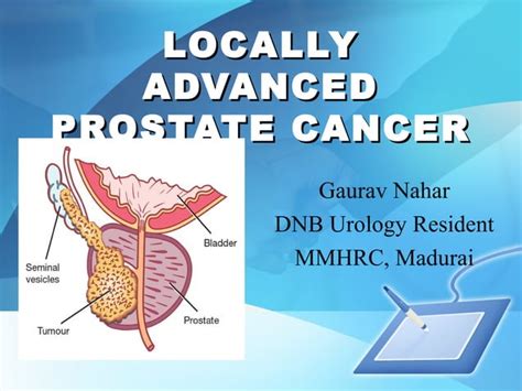 Lapc 170421131858 Pdf