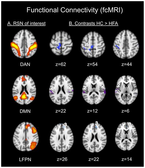 Functional Connectivity Between Group Differences A Resting State