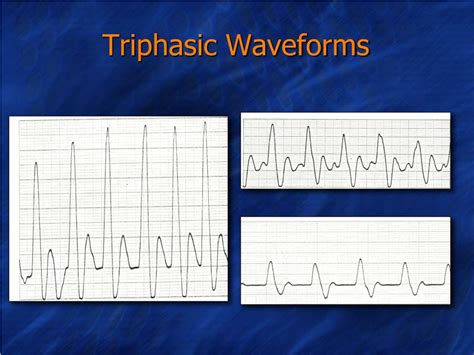 Ppt Vascular Surgery 101 Vascular Assessment And Pad Powerpoint