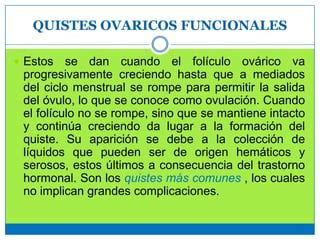 Quistes Ováricos Funcionales Up Med Pptx