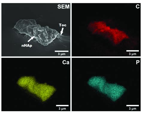 Representative Scanning Electron Microscope Sem Image And Elemental