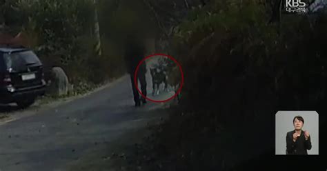 이웃집 개에 물려 손가락 절단…개 물림 사고 연간 2천 건