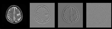 Wavelet Transform Of Mri Image Download Scientific Diagram