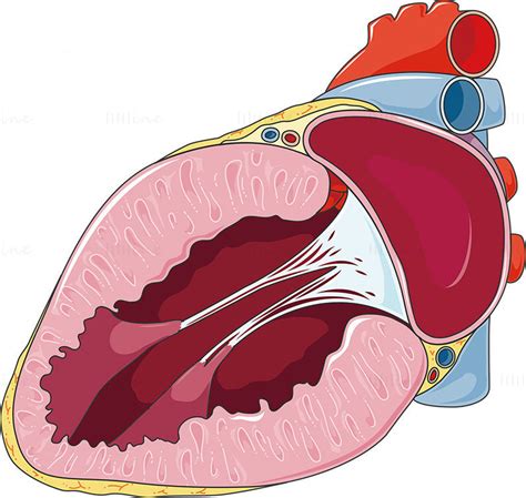 Left Ventricular Remodeling Following Myocardial Infarction Vector