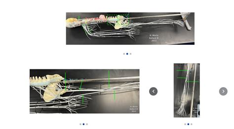 Nerve Plexuses And Peripheral Nerves P4 Diagram Quizlet