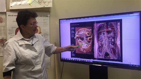 Кандида микоз слизистых оболочек Youtube