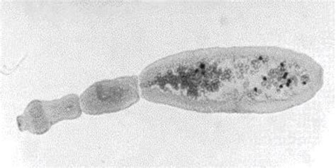 Figure 1 From Echinococcus Spp Tapeworms That Pose A Danger To Both