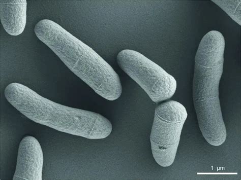 Corynebacterium Glutamicum Ist Bakterie Des Jahres 2025 Medlabportal