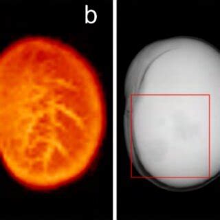 Radiographic Images Of Soybean Seeds Without Damage A And Seeds Download Scientific Diagram