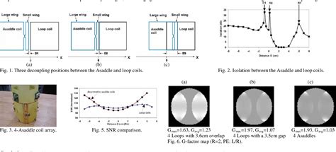 Figure 3 From Self Decoupled Asymmetric Saddle Coil Array For Sense Imaging Semantic Scholar