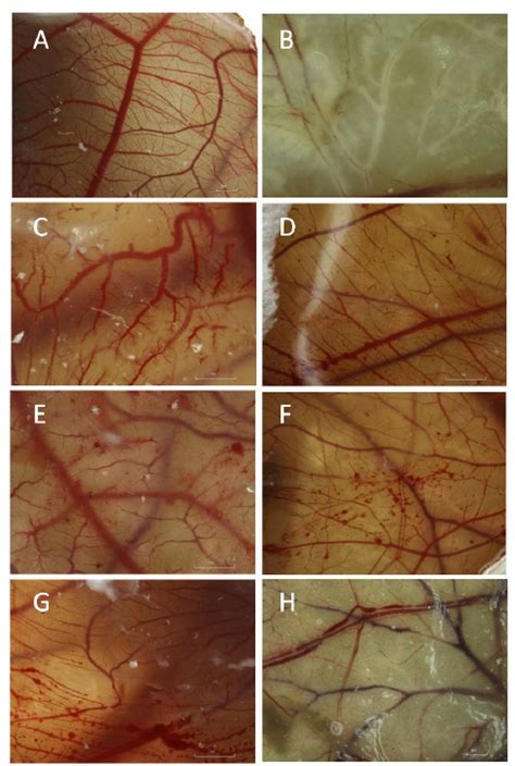 Scoring Guide Adapted From Burdic Et Al 2003 A Normal