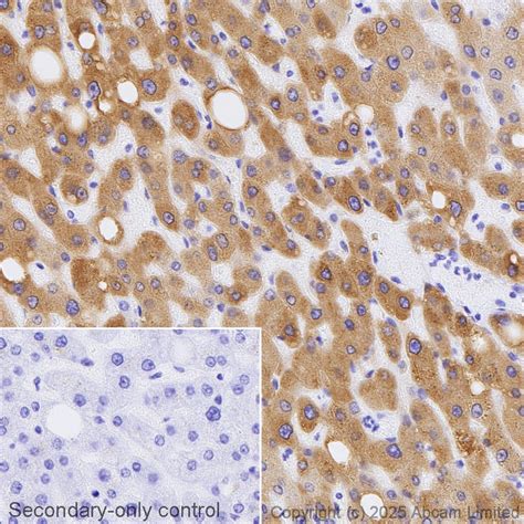 Avidinbiotin Blocking Kit 15 Ml Ab64212 Abcam