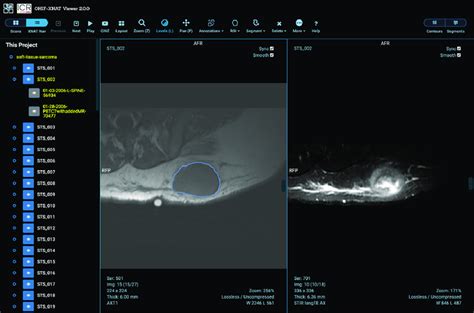 Open Health Imaging Foundation Ohif Xnat User Interface A Customized