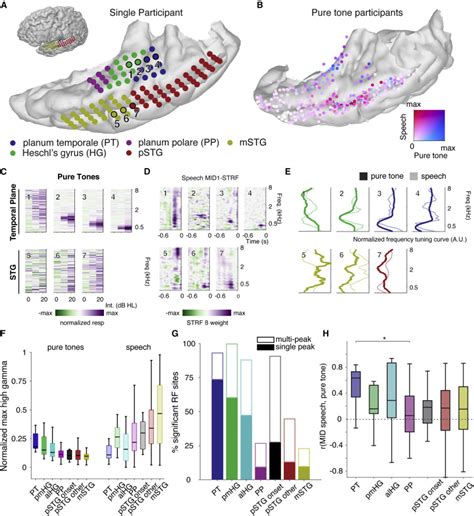 Parallel And Distributed Encoding Of Speech Across Human Auditory