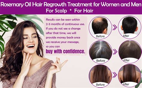 Rosemary Oil Hair Growth Serum With Biotincastor Oil Hair