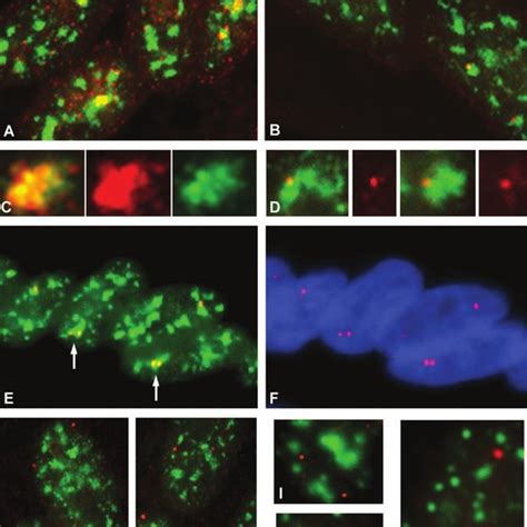 Detection Of Muscle Specific Genes Or Transcripts Red With Sc 35 Download Scientific Diagram