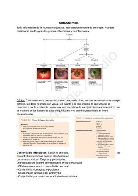 Conjuntivitis Medicinaestudio Udocz