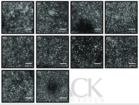 foveal adaptive optics scanning laser ophthalmoscope aoslo images in