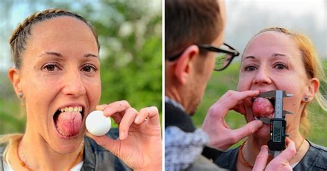 골프공보다 굵어” 세계서 가장 두꺼운 혀 가진 여성