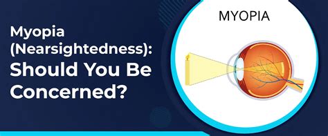 Myopia Nearsightedness Risks Causes And Prevention