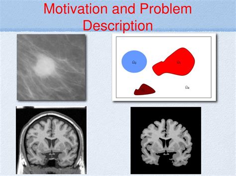 ppt mri brain extraction using a graph cut based active contour model