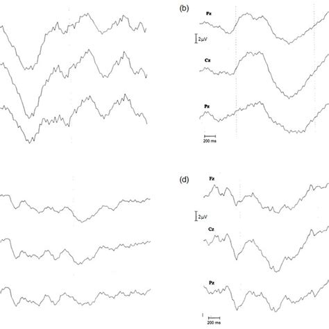 Filter Band Pass 00130 Hz Eeg Averaging From 500 Ms Pre Stimulus To