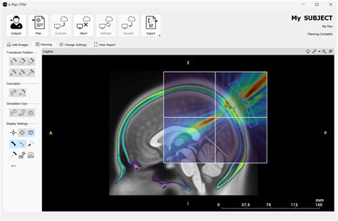 Graphical User Interface Ucl Centre For Advanced Research Computing