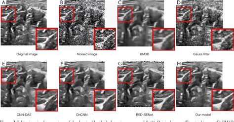 figure 3 from ultrasound image denoising autoencoder model based on