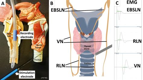 Intra Operative Neural Monitoring Of Thyroid Surgery In A Porcine Model