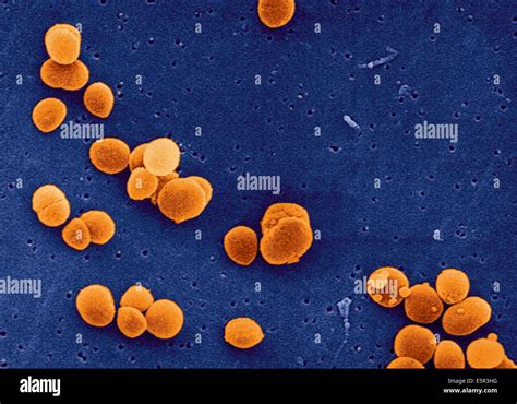 Color Ehanced Scanning Electron Micrograph Sem Of Staphylococcus Aureus Bacteria These Gram