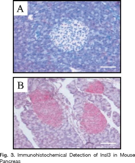Structure Of Gubernaculum Testis Semantic Scholar
