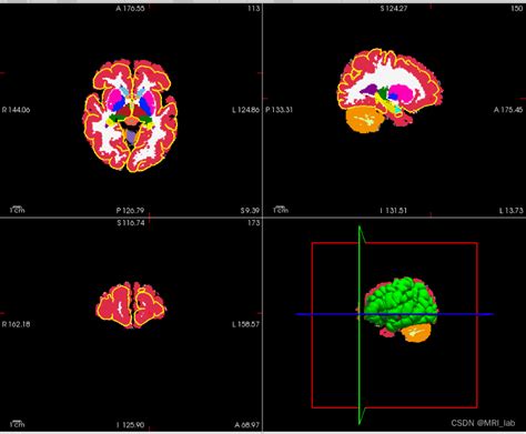 Infant Freesurfer安装和使用，适用于0 2岁婴幼儿大脑自动分割infant Freesurfer Csdn博客