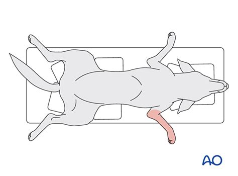 Bridging Plate On Radius And Intramedullary Pin Or Plate On Ulna For
