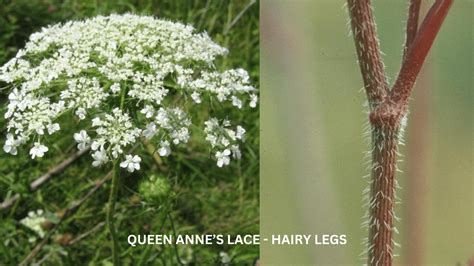 Queen Annes Hairy Legs Could Save Your Life