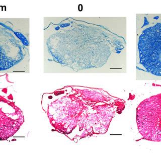Histological Staining At 6 Th Week After SCI One Of The Representative Download Scientific