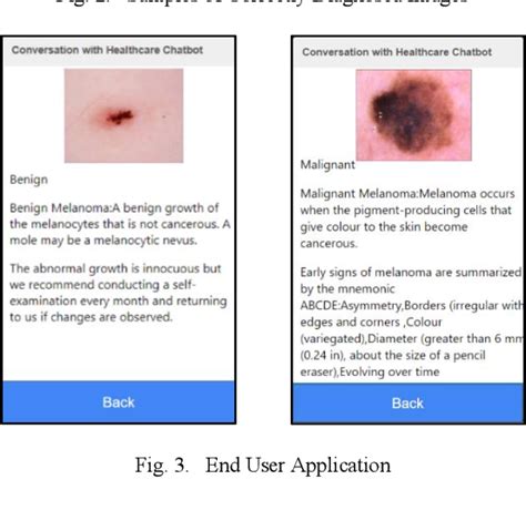 Figure 3 From Melanoma Detection Using Convolutional Neural Networks And Group Normalization