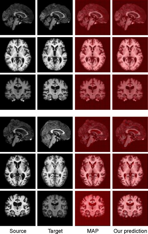 Figure 1 From Deep Learning For Regularization Prediction In