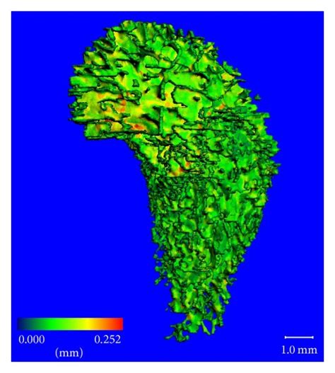 Three Dimensional Architecture Of Trabecular Bone Within The Distal