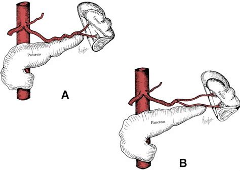 Splenic Artery Branches Collateral Pathways Between Dorsal Pancreatic