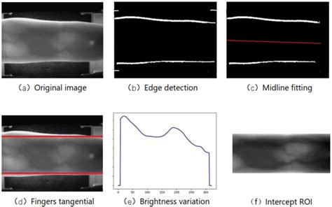 Figure 5 From Convolutional Neural Network Approach Based On Multimodal