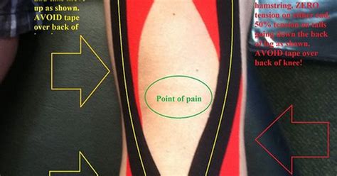 Pulled Hamstring Diagram 3 Types Of Pain In The Butt And What You Can