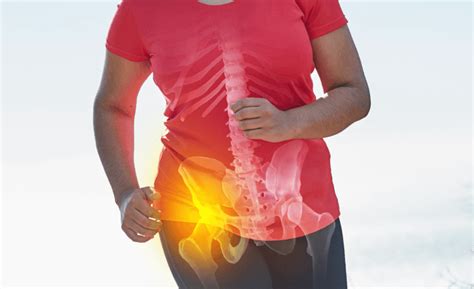 Hip Bursitis Treatment In Singapore Ioc Ortho