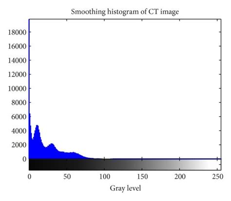 Histogram And Smoothing Histogram Of Ct Slice Download Scientific