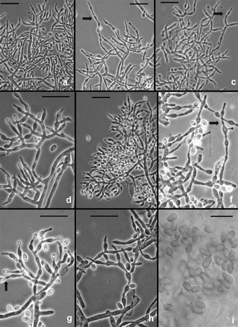 Trichoderma Neokoningii A B Colonies On Pda A And Sna B After 1