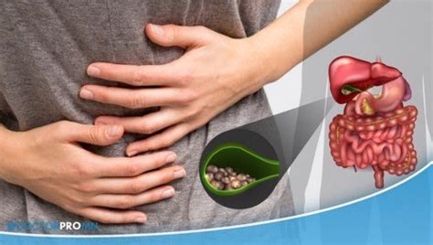 Цөсний чулууг 7 хоногийн дотор гадагшлуулах хятадын нууц арга Ospring